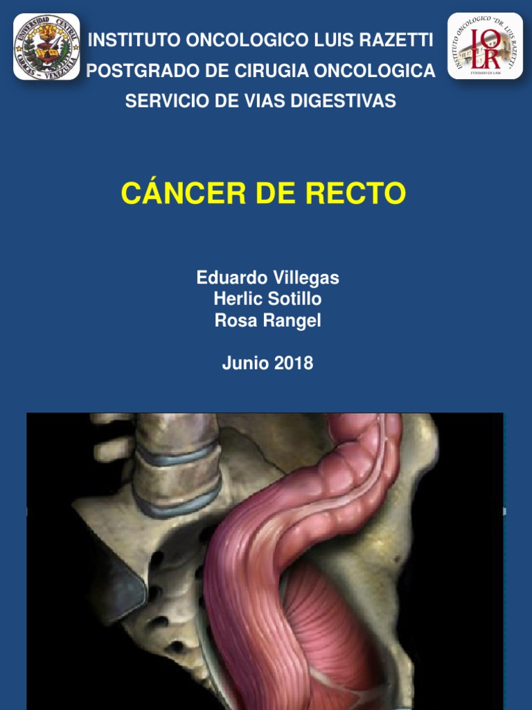 Cancer de Recto 2018 | PDF | Cáncer | Cáncer colonrectal