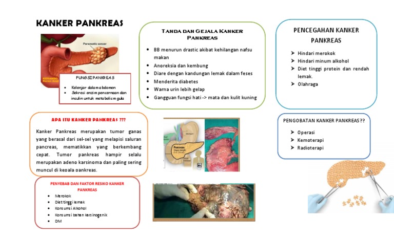 Kanker Pankreas Pdf