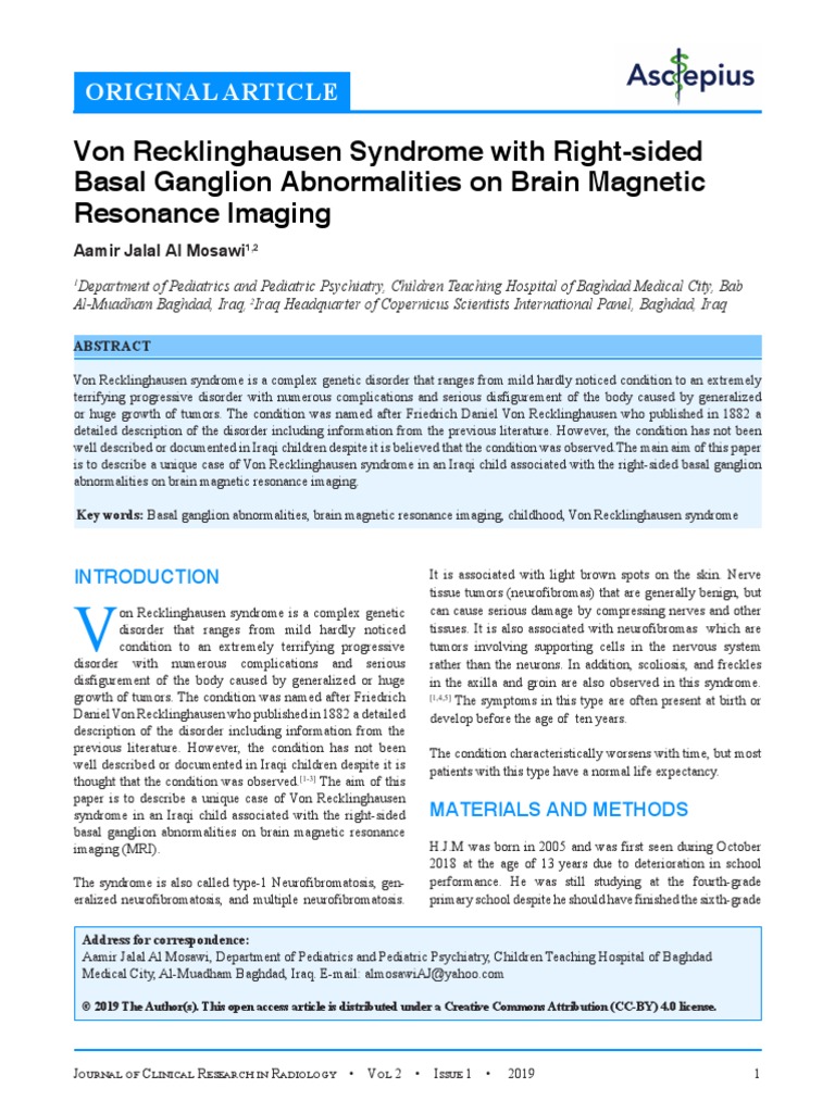 Von Recklinghausen Syndrome With Right-Sided Basal Ganglion ...