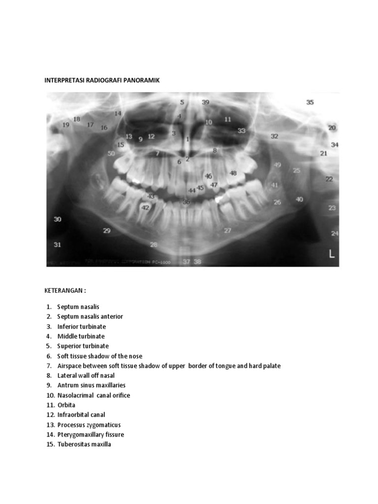 Interpretasi Radiografi Panoramik | PDF
