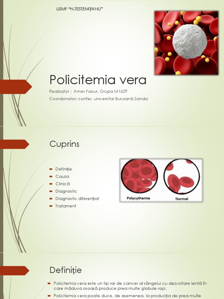 Policitemia Vera | PDF