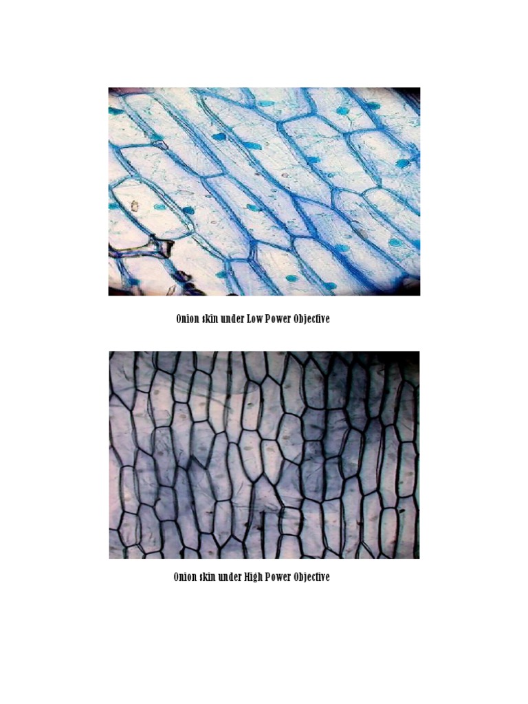 Onion Skin Under Low Power Objective | PDF