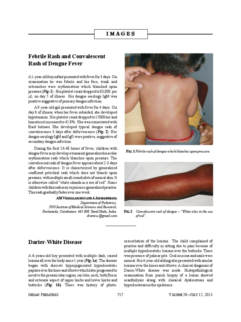 Convalescent Rash in Dengue Fever | PDF | Fever | Medical Specialties