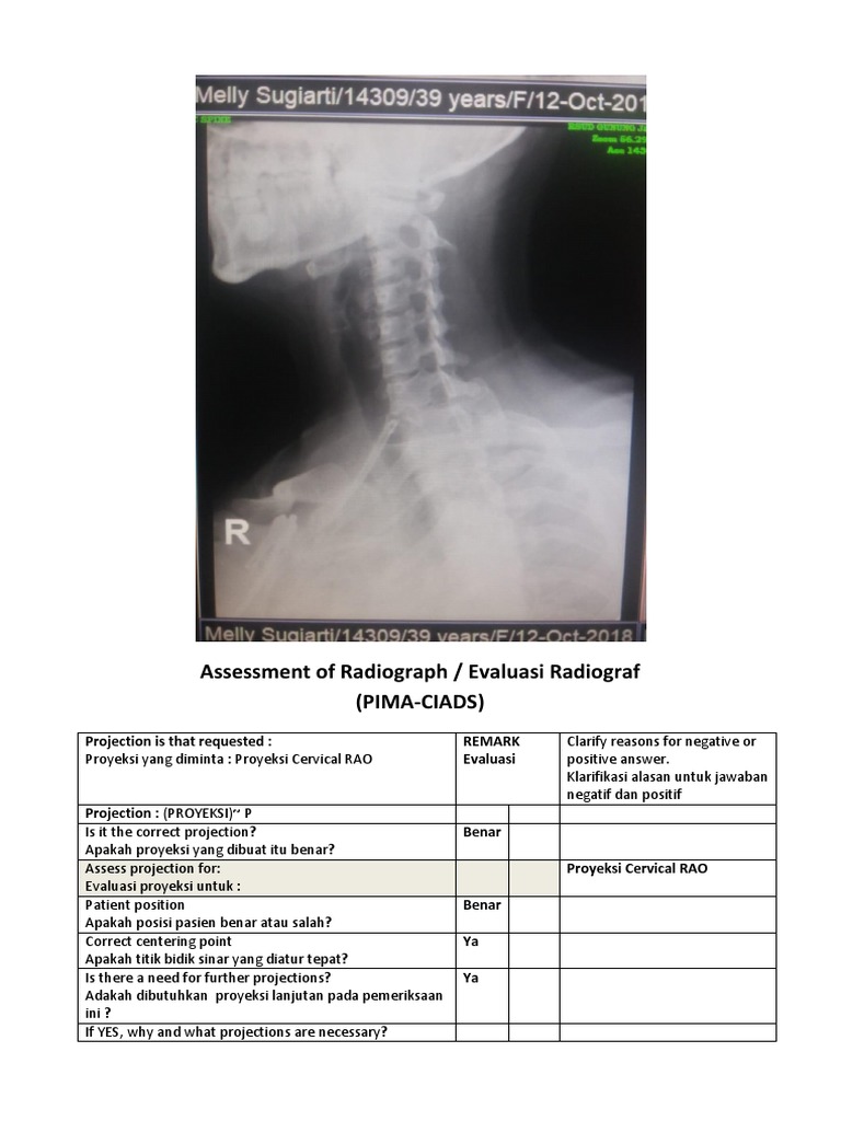 Evaluasi Radiograf Cervical RAO | PDF