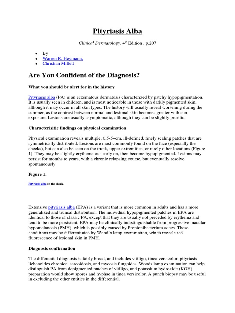 Pityriasis Alba: Are You Confident of The Diagnosis? | PDF | Topical ...