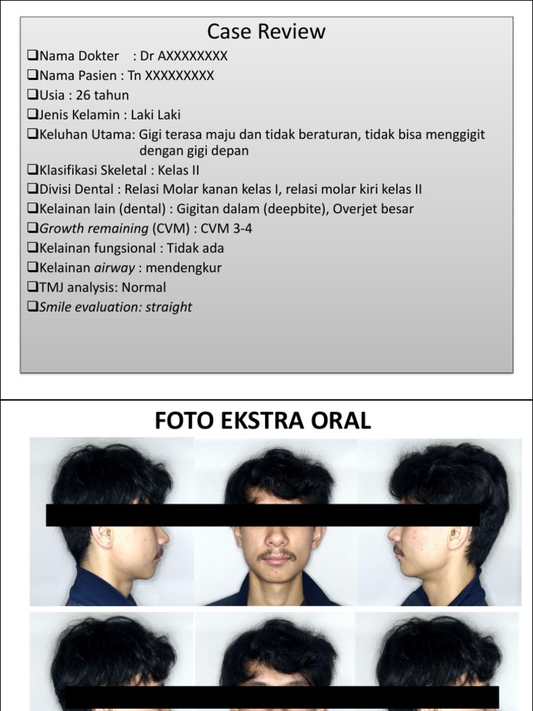 Case Review: Growth Remaining (CVM) : CVM 3-4 | PDF | Animal Anatomy ...