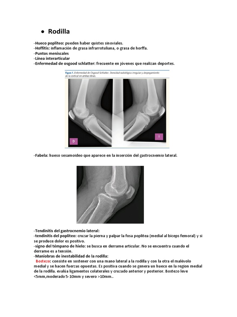 Signo del Témpano y Fabela en Rodilla | PDF | Rodilla | Pie