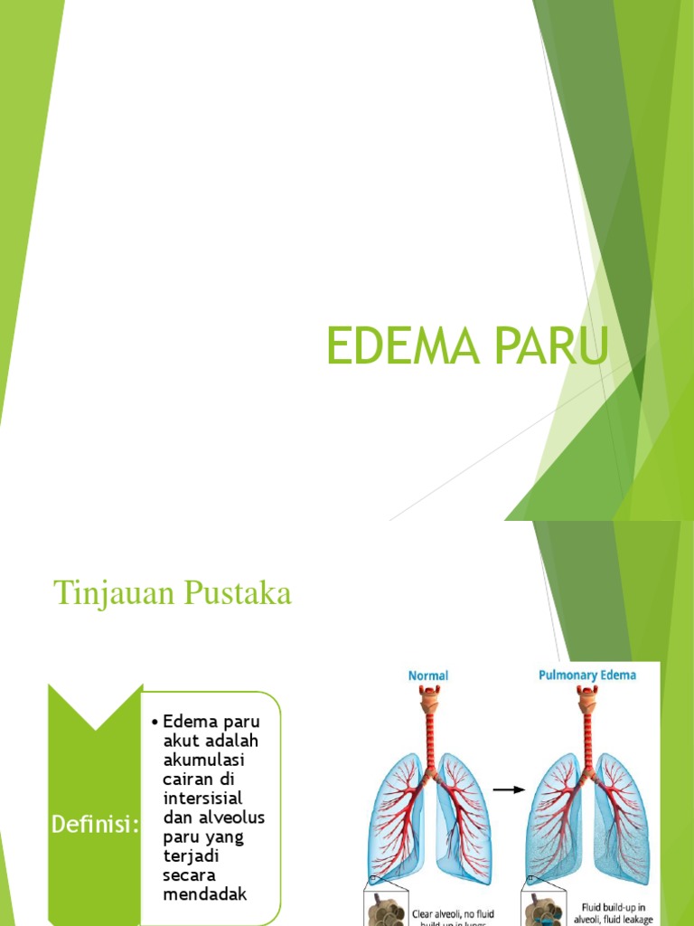 Edema Paru | PDF