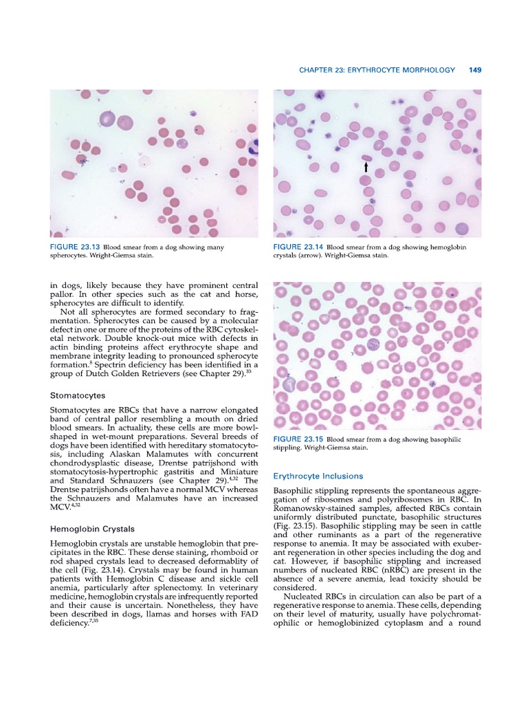 Hemoglobin C Crystals
