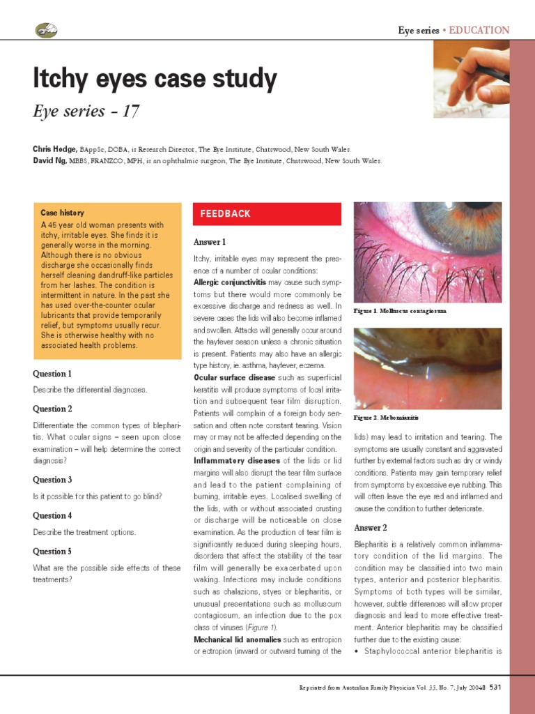 Itchy Eyes Case Study: Eye Series - 17 | PDF | Ophthalmology | Medical ...