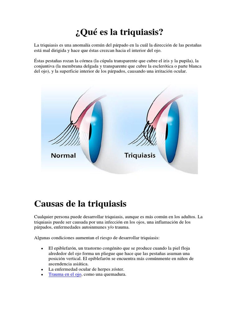 Triquiasis | PDF | Ojo humano | Oftalmología