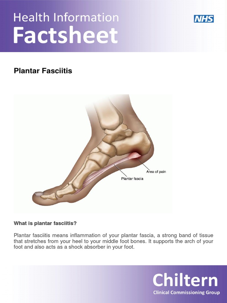 Understanding Plantar Fasciitis: A Guide | PDF | Foot | Lower Limb Anatomy