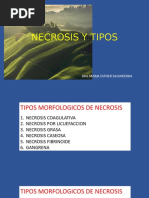 Tipos de Necrosis | PDF | Inflamación | Causas de la muerte