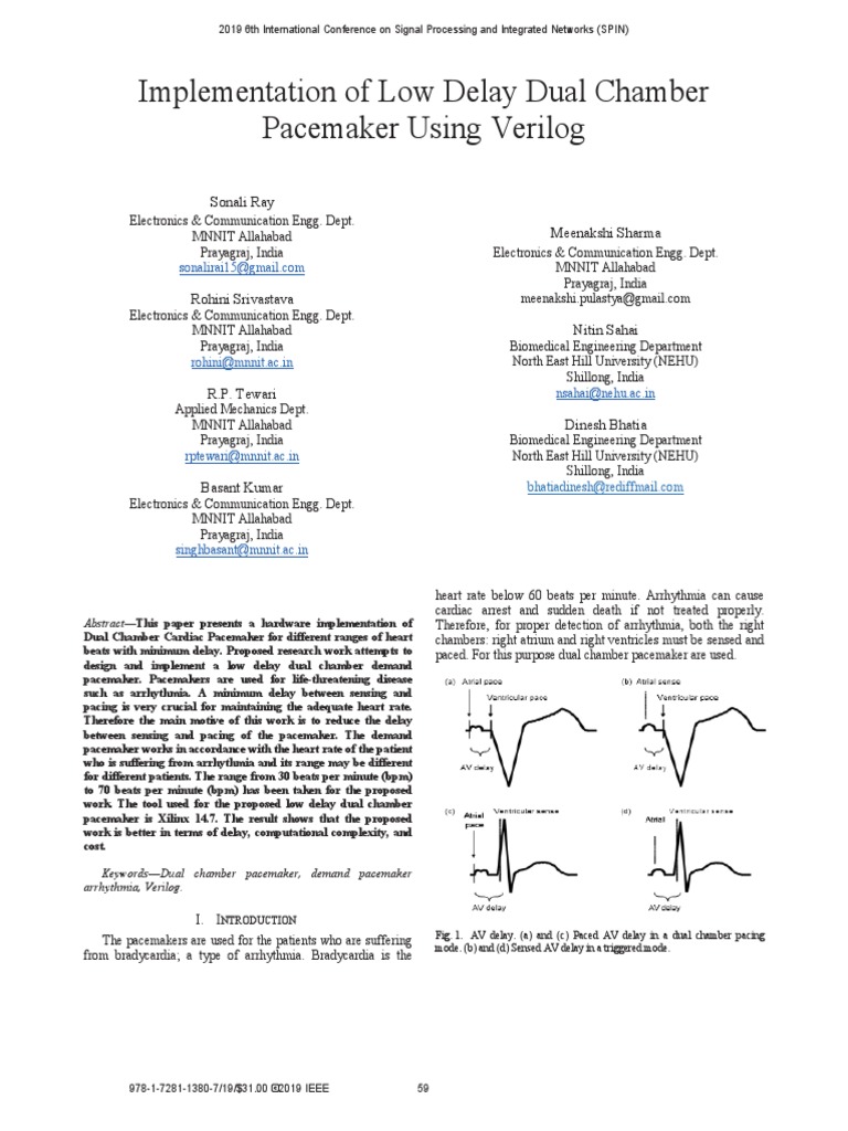 Implementation of Low Delay Dual Chamber Pacemaker Using Verilog | PDF | Artificial Cardiac ...