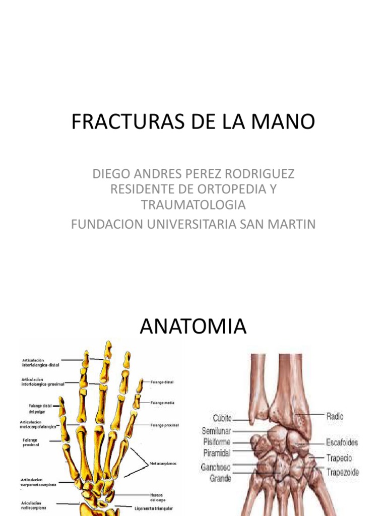 Fracturas De La Mano | Traumatologia | Trastornos musculoesqueléticos ...