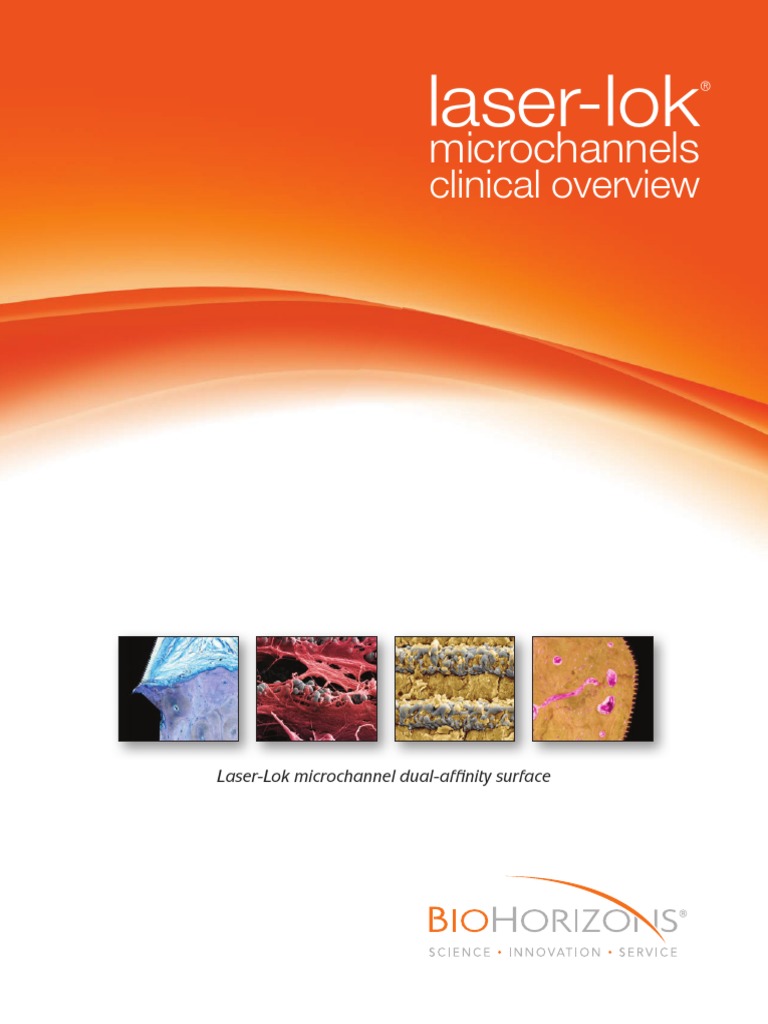 Laser Lok | PDF | Dental Implant | Mouth