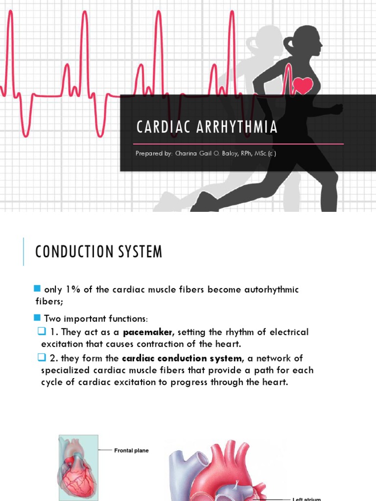 CARDIAC ARRHYTHMIA GUIDE | PDF | Heart | Atrium (Heart)