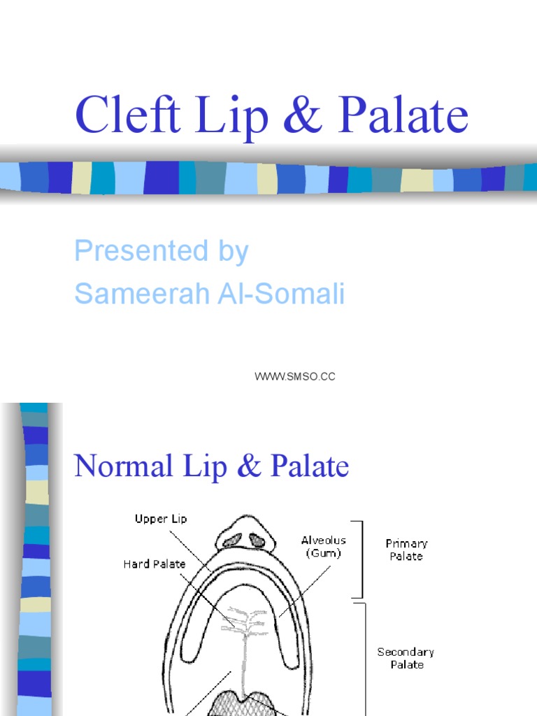 Cleft Lip and Palate Overview | PDF | Health Sciences | Diseases And ...