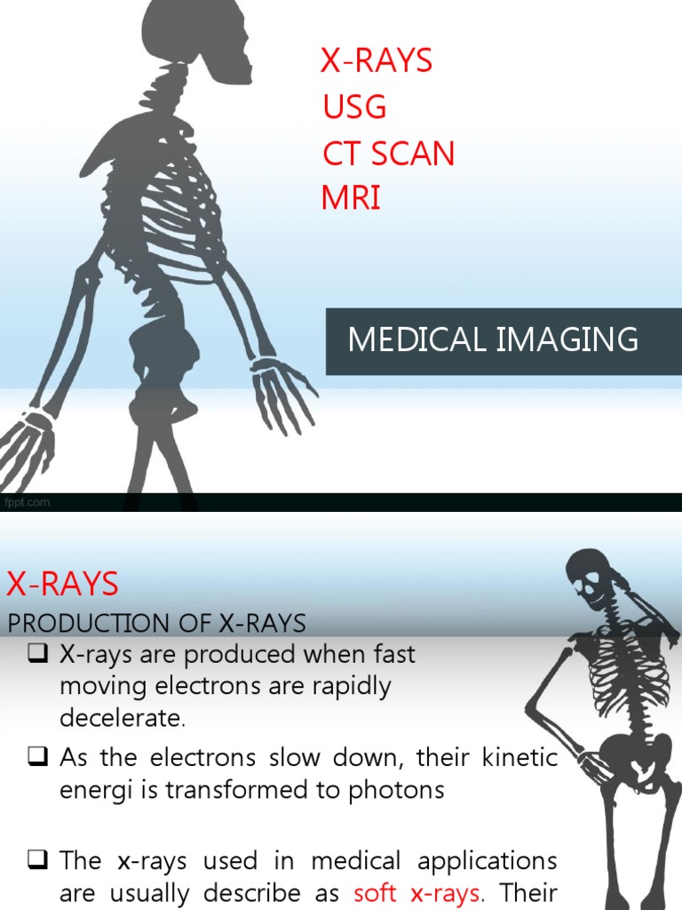 X-Rays USG CT Scan MRI: Medical Imaging | PDF