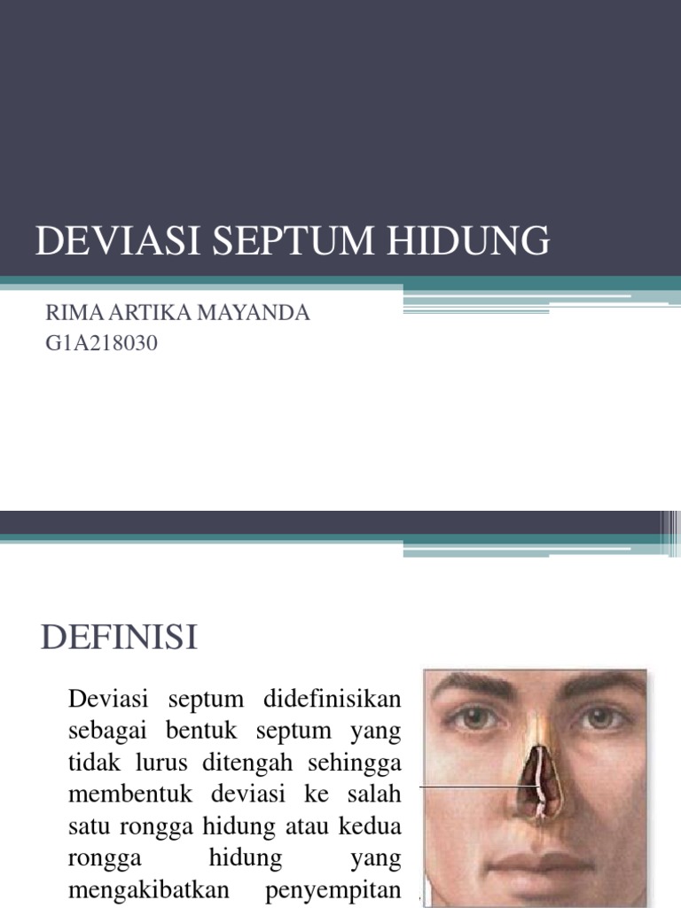 Deviasi Septum Nasi | PDF | Pengembangan Diri | Kesehatan Holistik