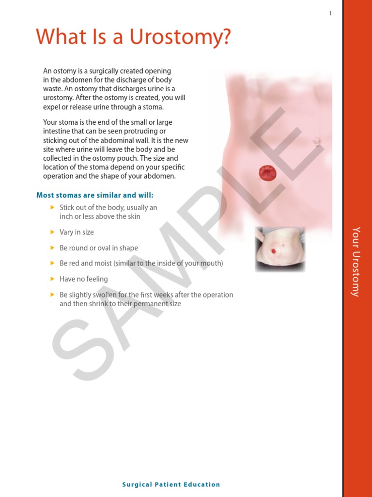 Your Urostomy | PDF | Urinary Bladder | Urology