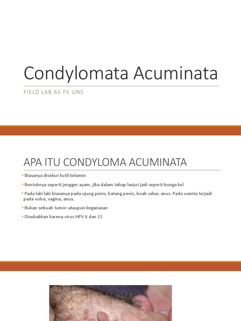 Condylomata Acuminata | PDF