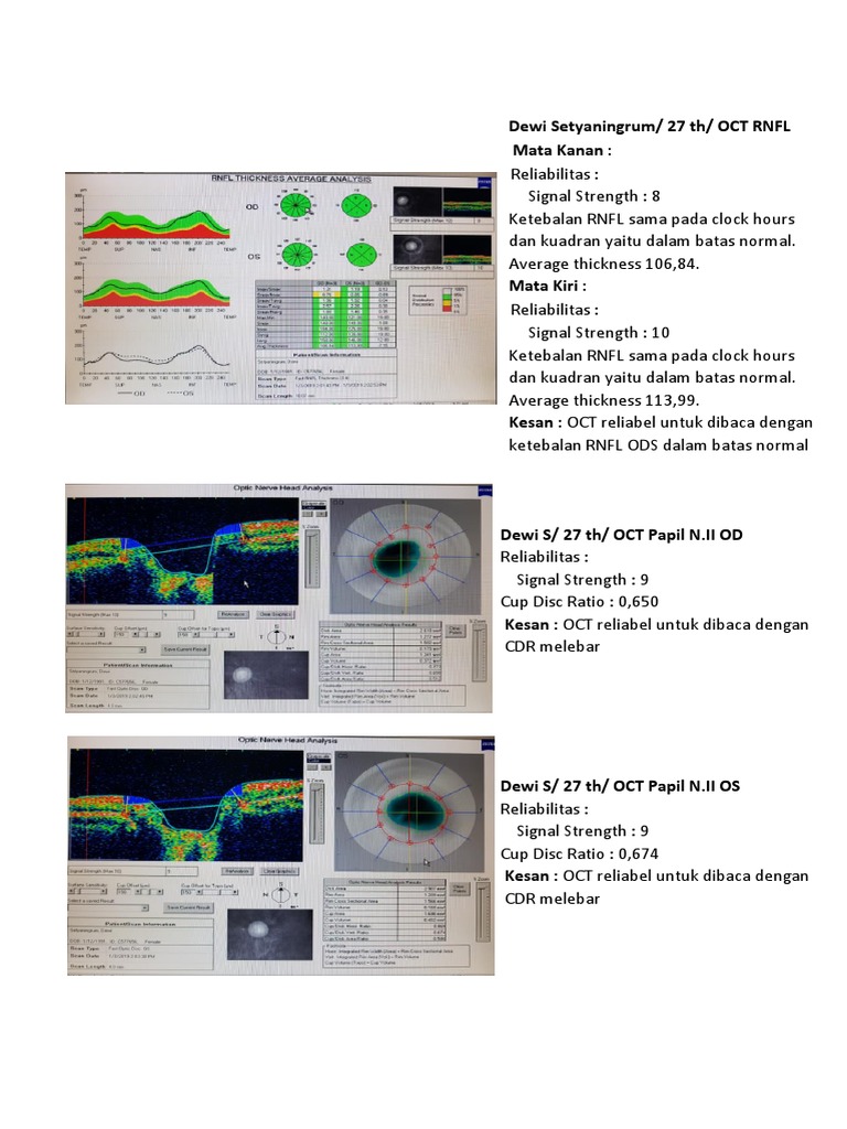 Hasil Pemeriksaan OCT Mata Pasien | PDF | Sains & Matematika