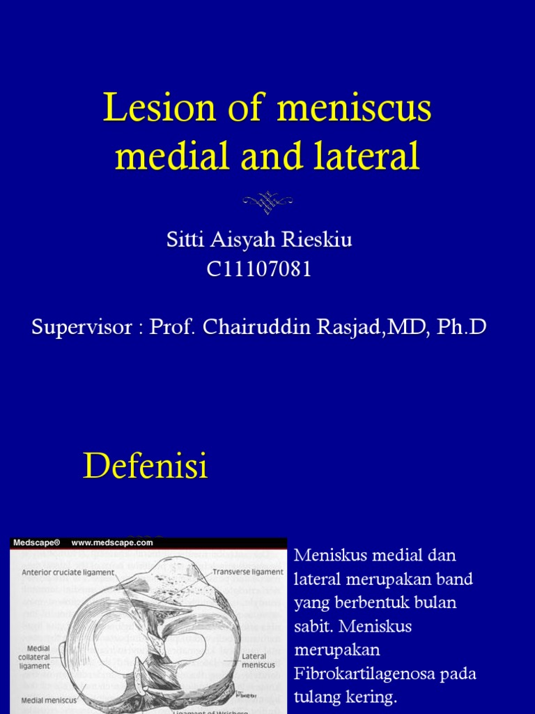 Lesion of Meniscus Medial and Lateral (Autosaved) | PDF | Ilmu Sosial | Kesehatan Holistik