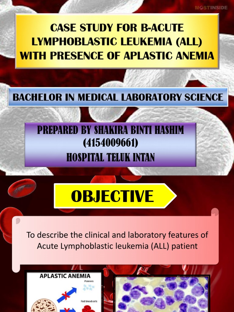 Case Study For Beta Acute Lymphoblastic Leukemia (B-All) | PDF | White ...