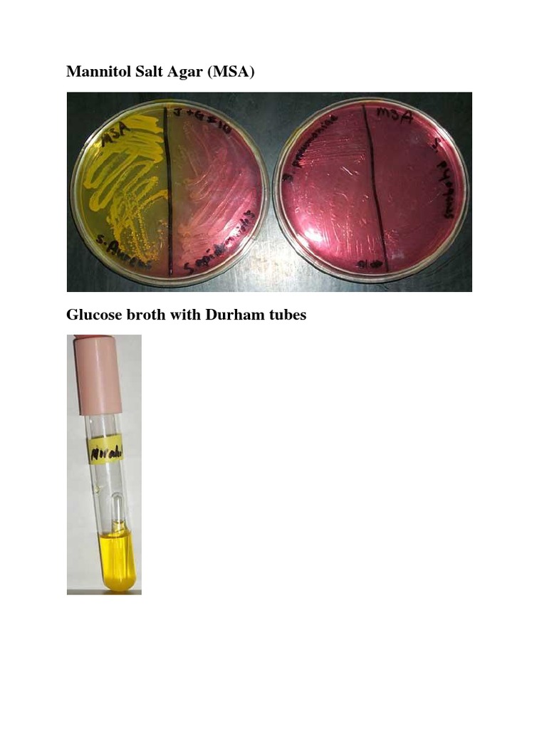 Mannitol Salt Agar | PDF