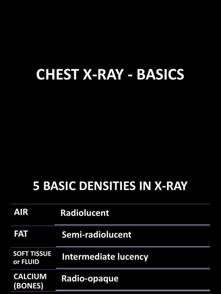 Chest X-Ray Basics | Download Free PDF | Thorax (Human Anatomy) | Lung