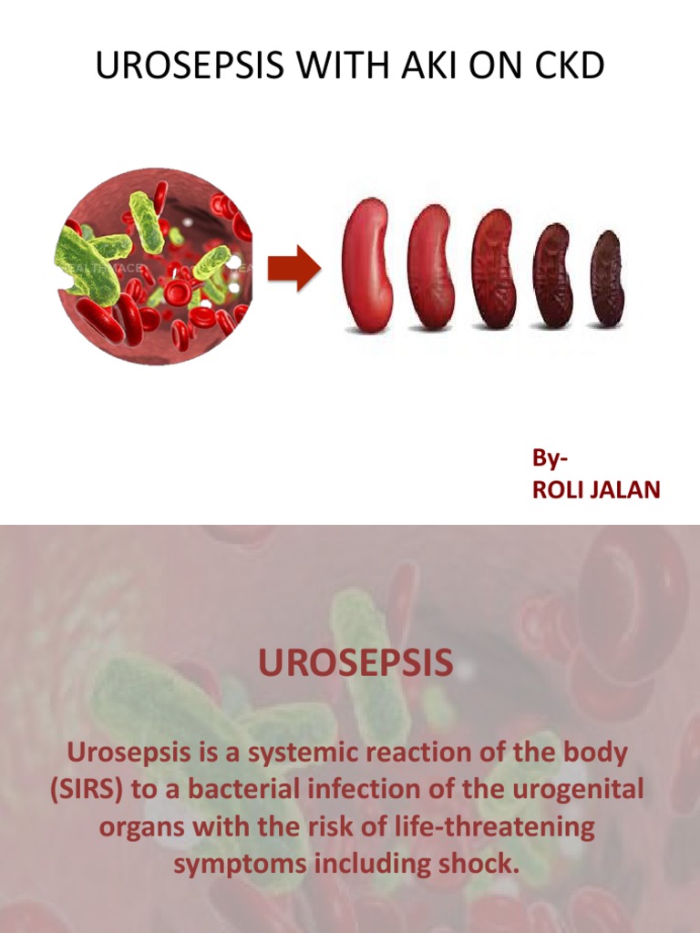 Urosepsis With Aki On CKD: By-Roli Jalan | PDF | Chronic Kidney Disease ...