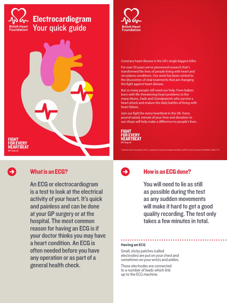 Ecg Quick Guide PDF | PDF | Electrocardiography | Heart