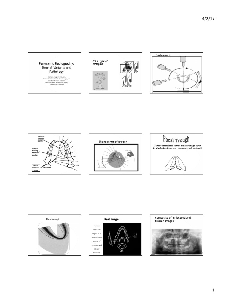 Panoramic Radiology Normal Variants and Pathology PDF | PDF | Human ...