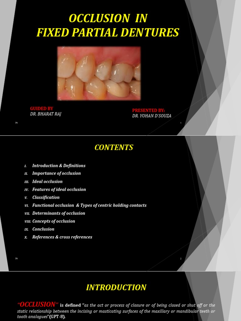 6 - Occlusion in FPD | PDF | Human Tooth | Dentistry Branches