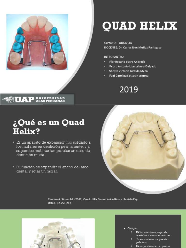 Uso y Activación del Quad Helix en Ortodoncia | PDF | Odontología | Boca