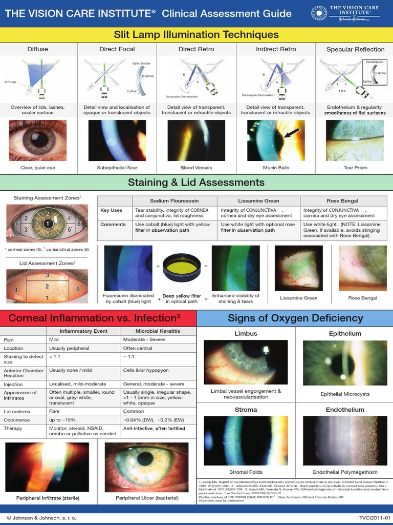 Clinical Assessment Guide | PDF | Cornea | Ophthalmology