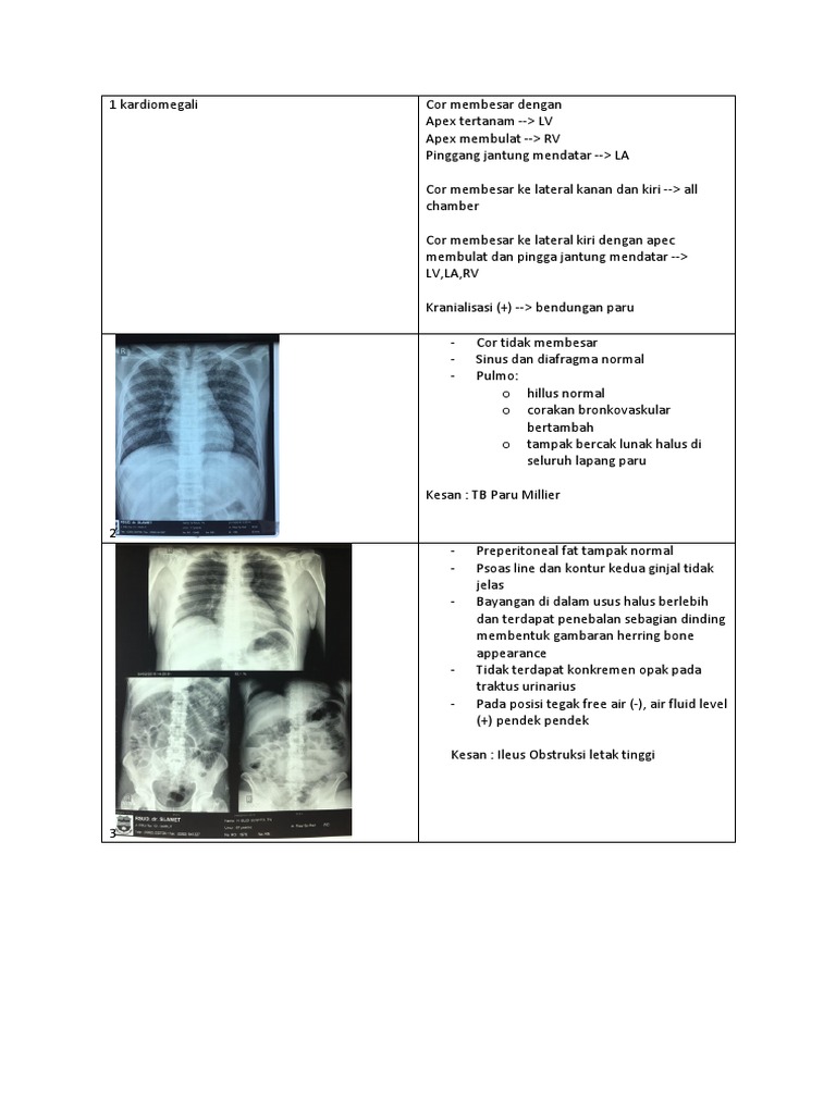Rontgen Thorax | PDF