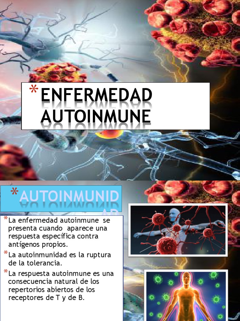 Enfermedades Autoinmunes: Causas y Tipos | PDF | Enfermedad autoinmune ...