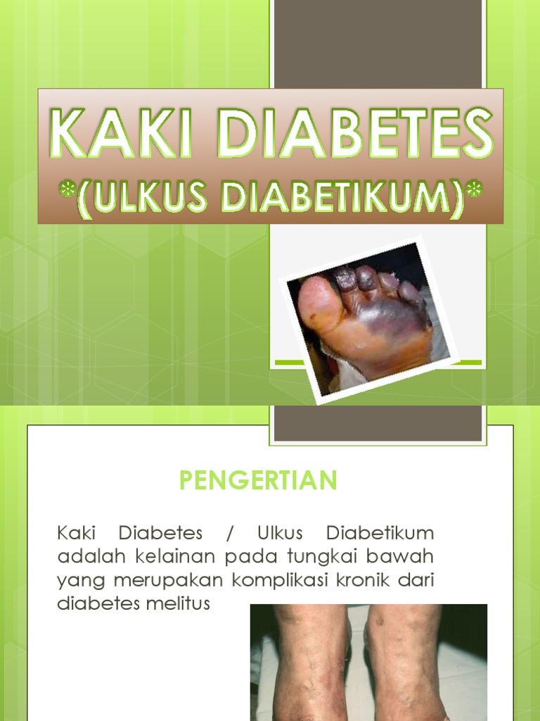 Penyuluhan Ulkus DM | PDF