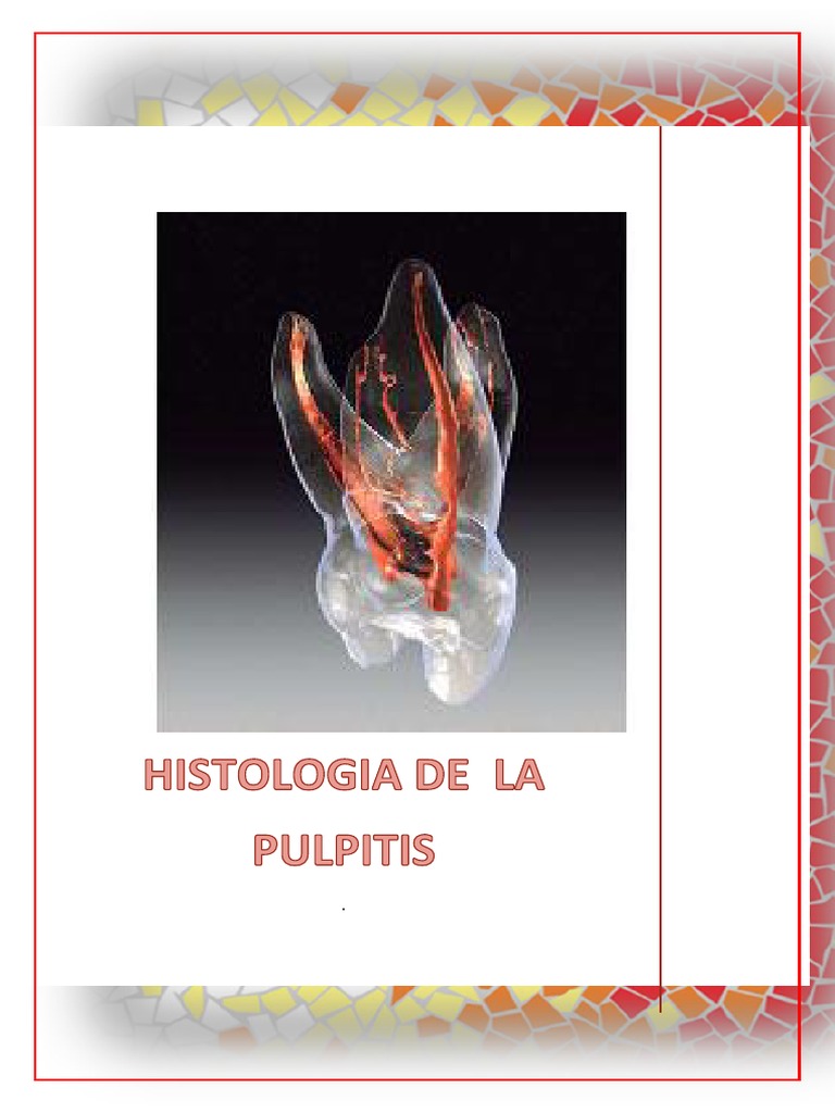 Dokumen - Tips - Histologia de La Pulpitis PDF | PDF | Inflamación | Enfermedades y trastornos