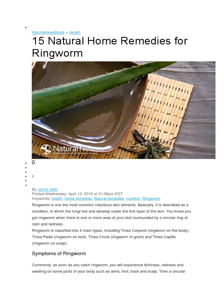 15 Natural Home Remedies For Ringworm: Naturalnewsblogs Health | PDF ...