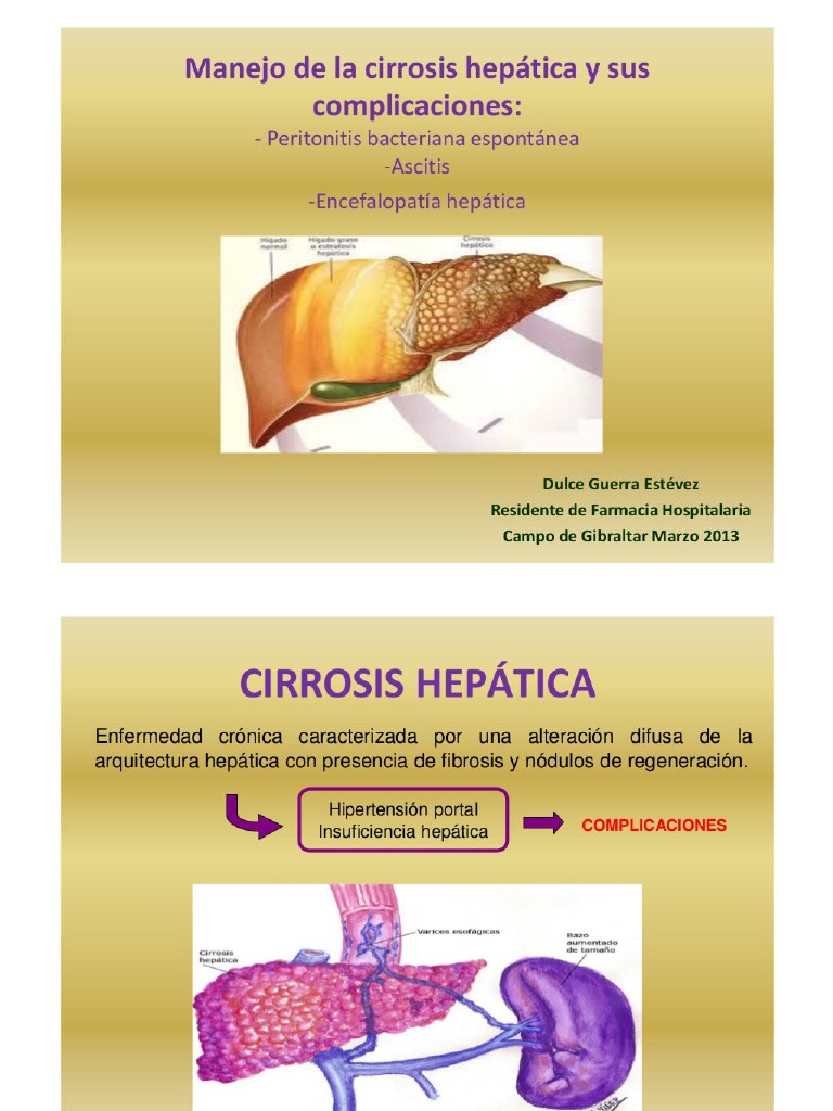 Manejo de La Cirrosis Hepatica y Sus Complicaciones | PDF
