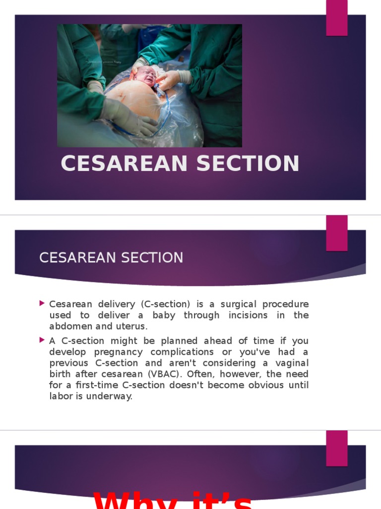 Cesarean Section And Surgical Instruments Pdf Caesarean Section