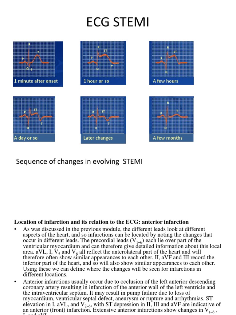 Ecg Stemi: Sequence of Changes in Evolving STEMI | PDF | Myocardial ...