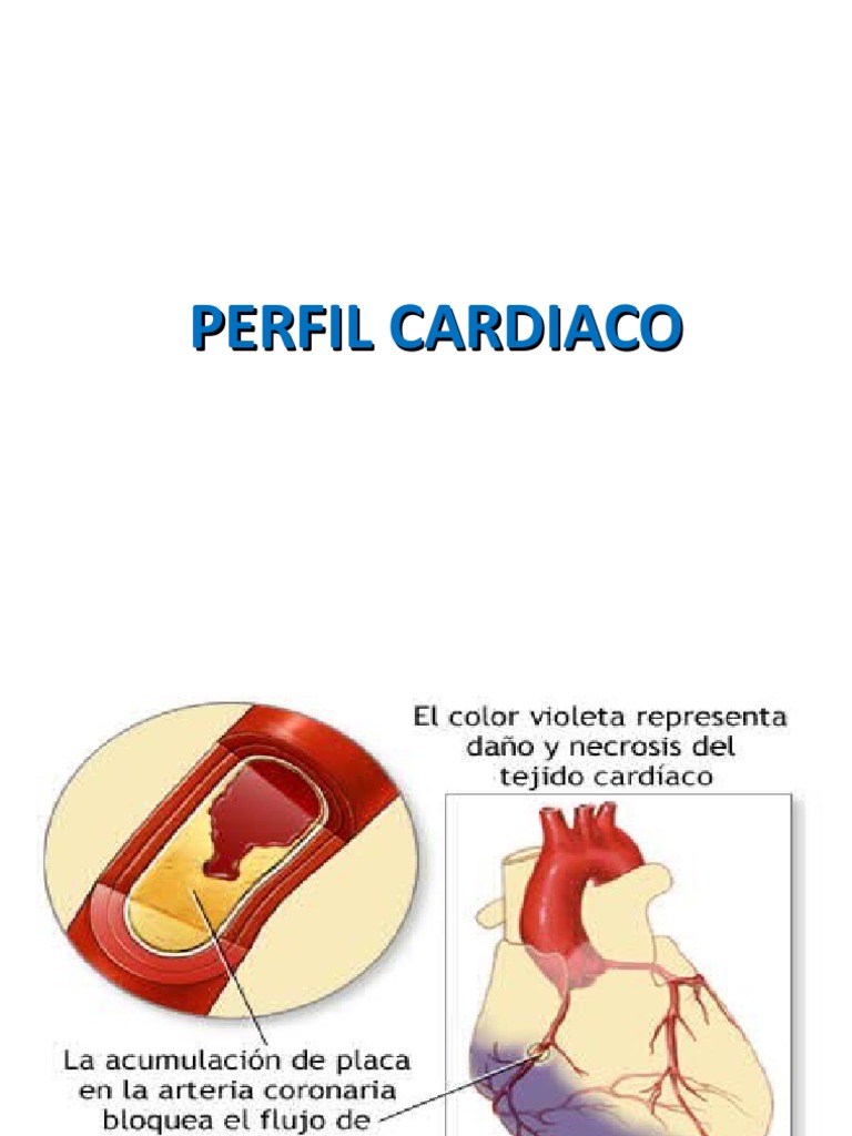 Análisis del Perfil Cardíaco y Marcadores | PDF | Transaminasa | Órgano ...