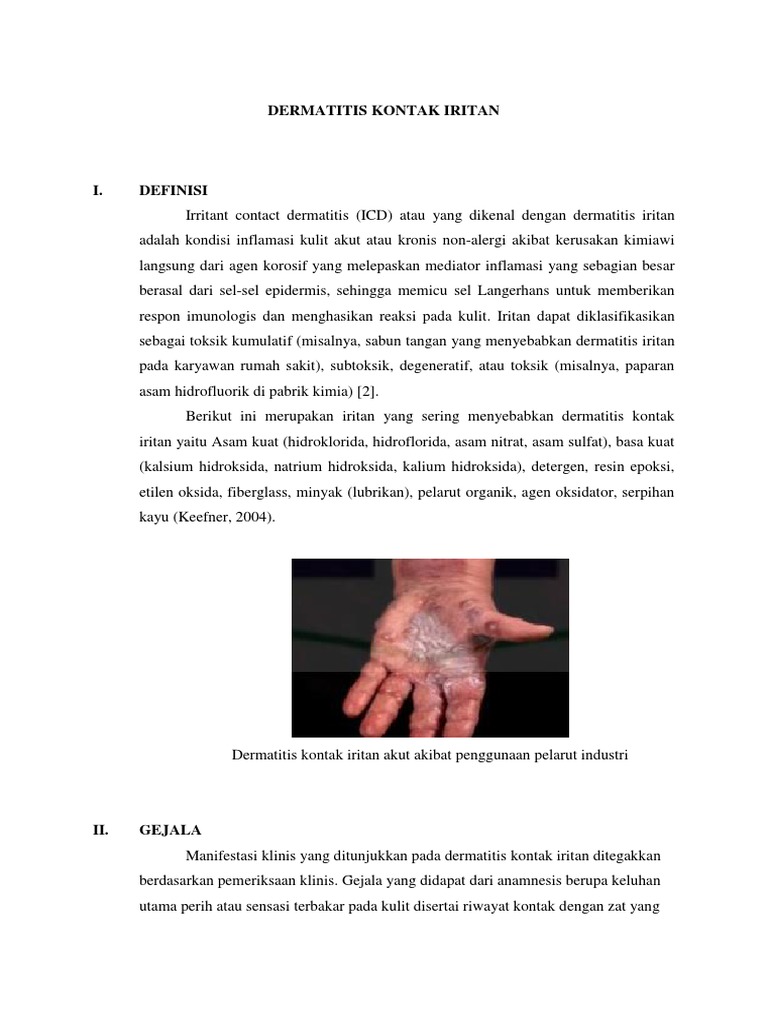 Dermatitis Kontak Iritan | PDF