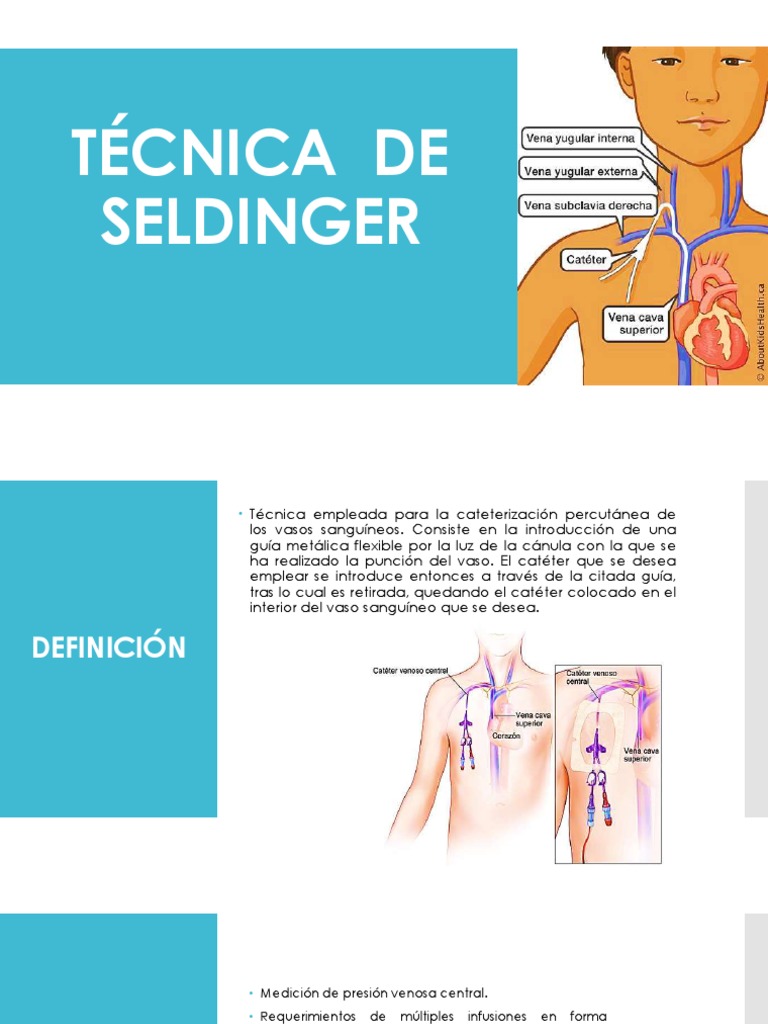 Procedimiento de Seldinger | PDF | Hemodiálisis | Medicina CLINICA