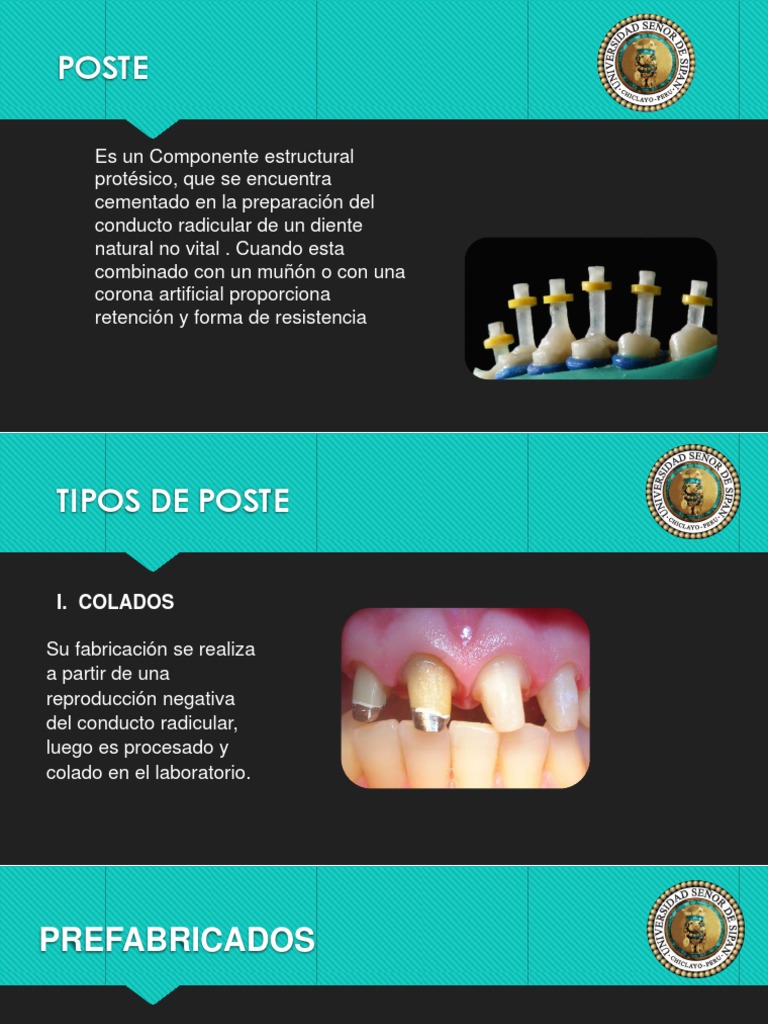 Tipos de Postes | PDF | Lentes | Rieles