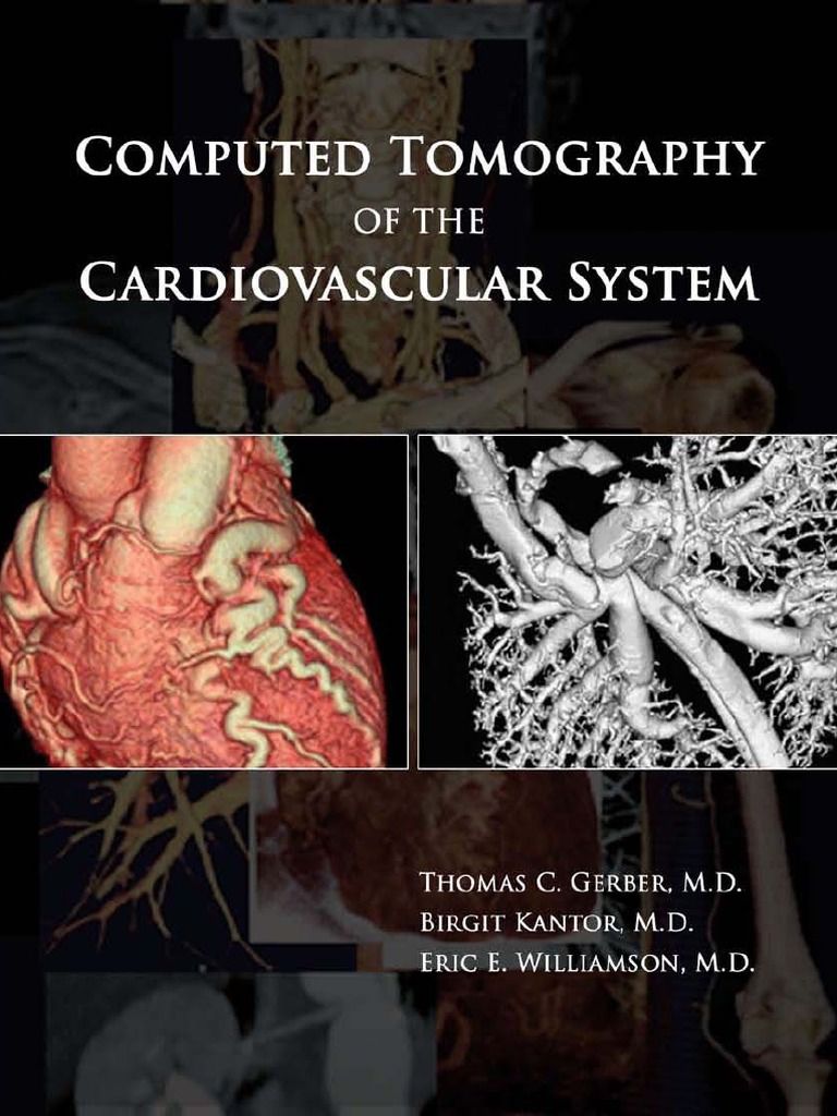 Computed Tomography of The Cardiovascular System PDF | PDF | Ct Scan ...